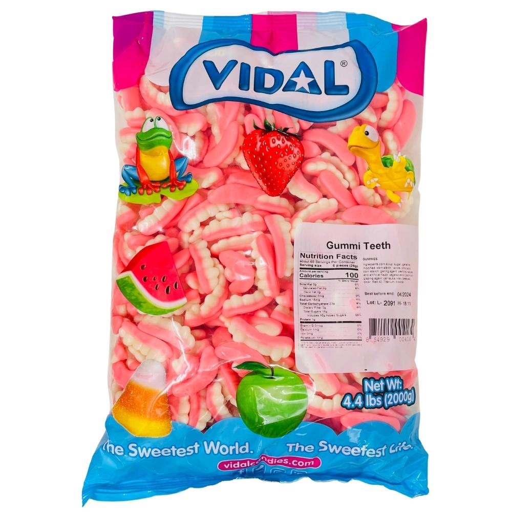 Vidal Gummi Teeth - 4.4lbs | Candy Funhouse – Candy Funhouse CA